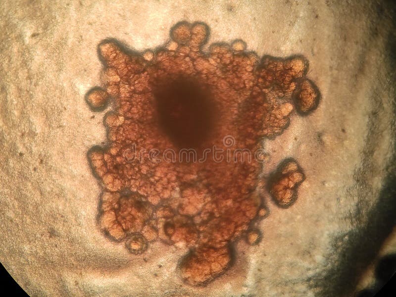 Structures Built by Bacteria Under the Microscope - Beautiful Growth ...