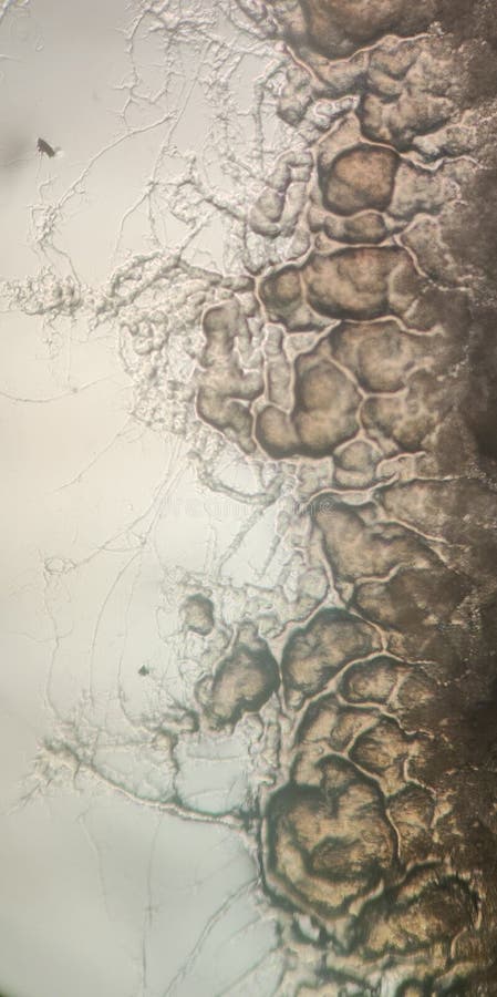 Beautiful Bacterial Colony Under the Microscope Stock Image - Image of ...