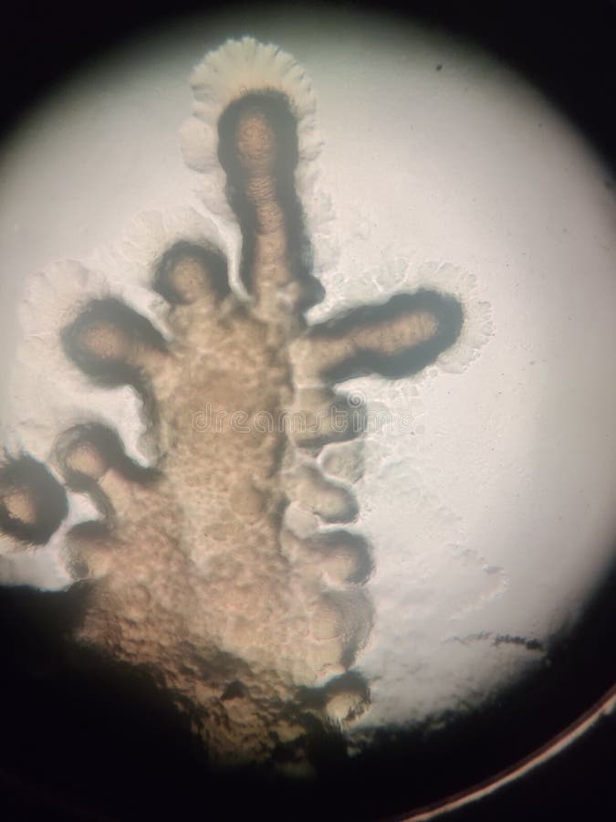 Beautiful Fractal Pattern Growth of a Bacterial Colony Under the ...