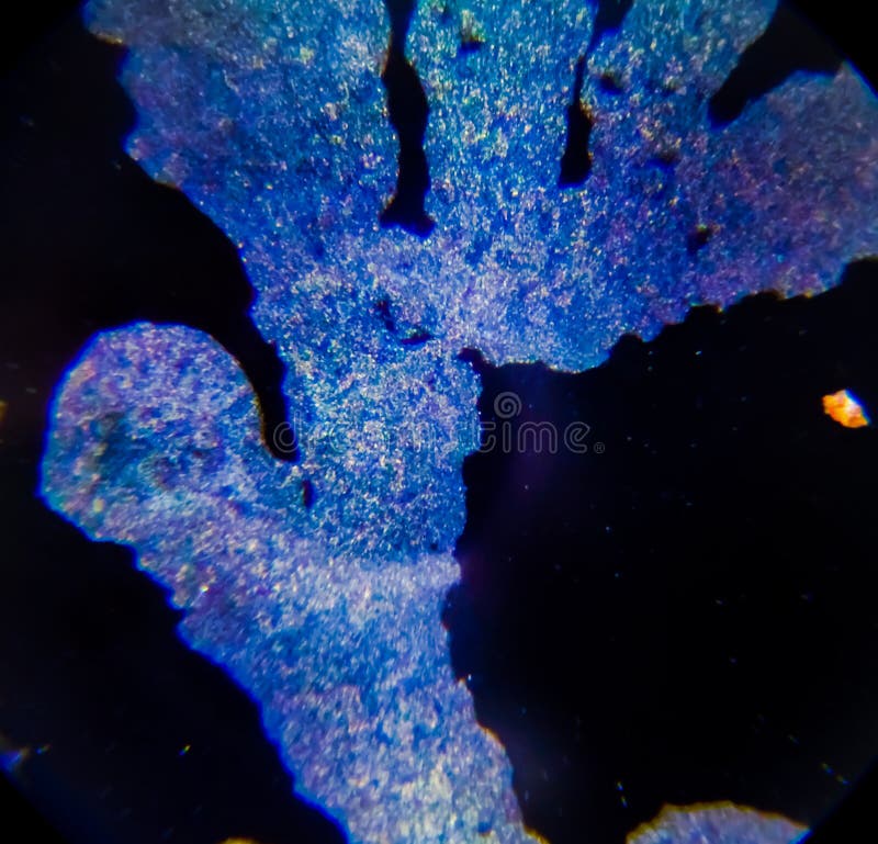 Bacillus Subtilis Beautiful Bacterial Growth Under the Microscope Stock ...