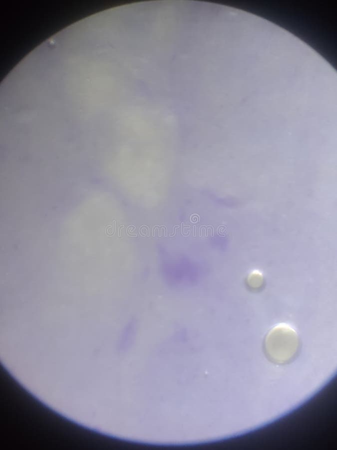 The Brain of a Pig Under the Microscope Stock Photo - Image of meat ...