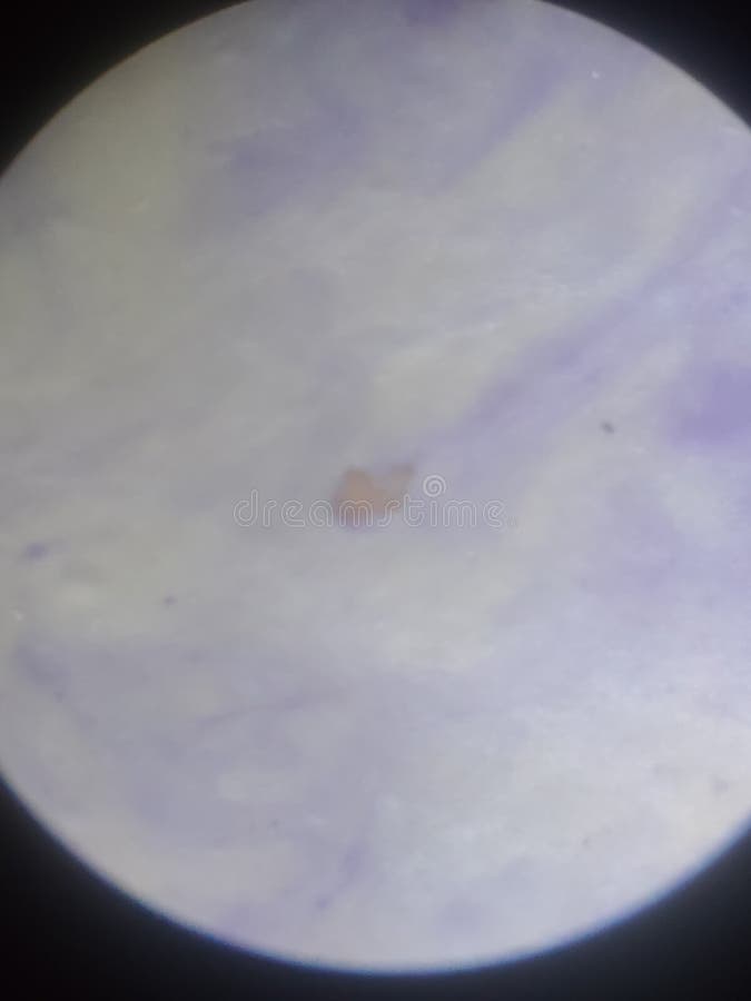 The Brain of a Pig Under the Microscope Stock Photo - Image of ...