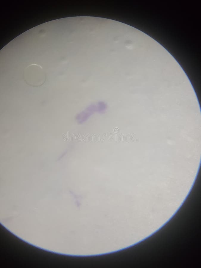 The Brain of a Pig Under the Microscope Stock Image - Image of biology ...