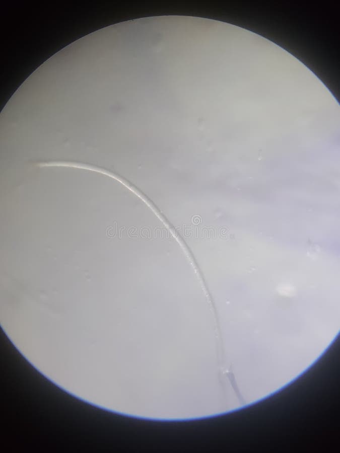 The Brain of a Pig Under the Microscope Stock Photo - Image of cell ...