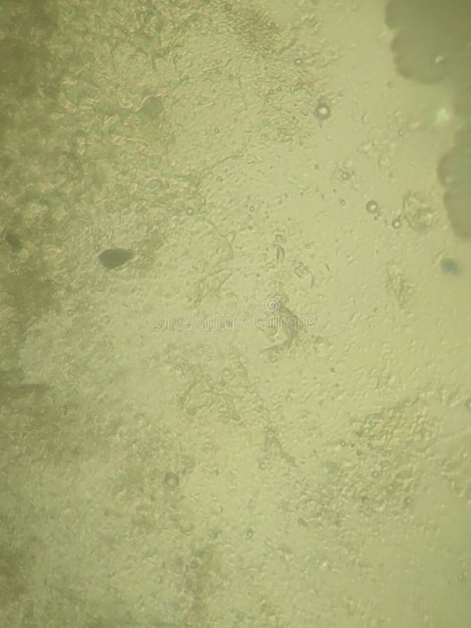 The Brain of a Pig Under the Microscope Stock Photo - Image of biology ...