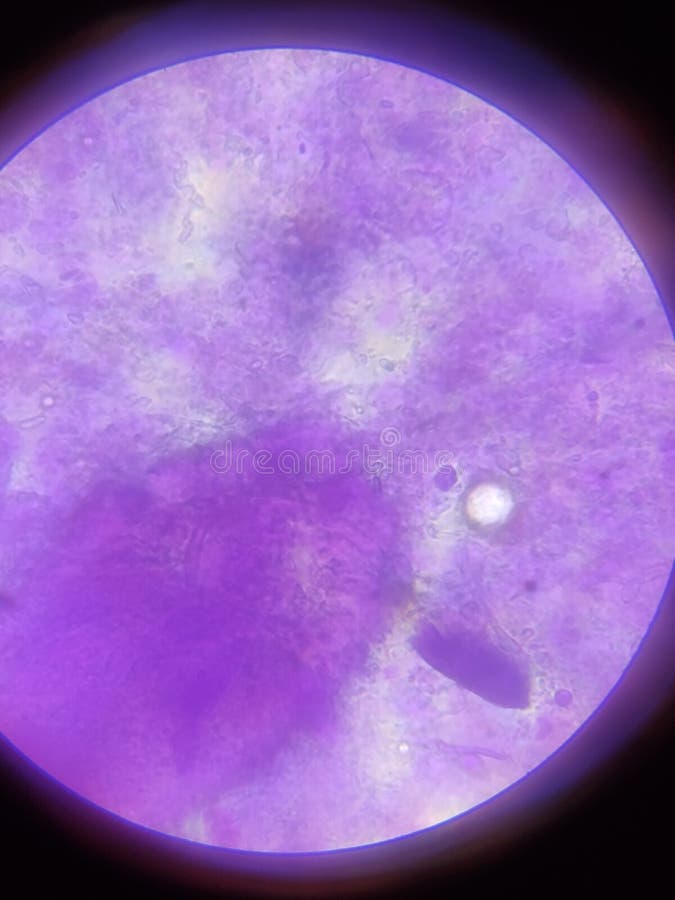 The Brain of a Pig Under the Microscope Stock Image - Image of tissue ...