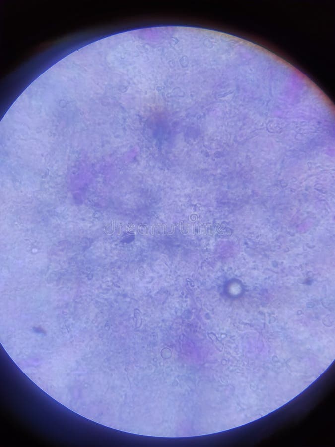 The Brain of a Pig Under the Microscope Stock Photo - Image of ...