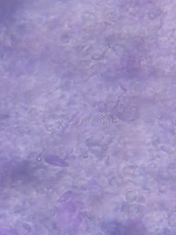 The Brain of a Pig Under the Microscope Stock Photo - Image of neurons ...