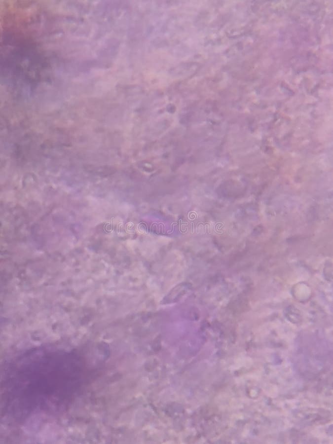 The Brain of a Pig Under the Microscope Stock Photo - Image of biology ...