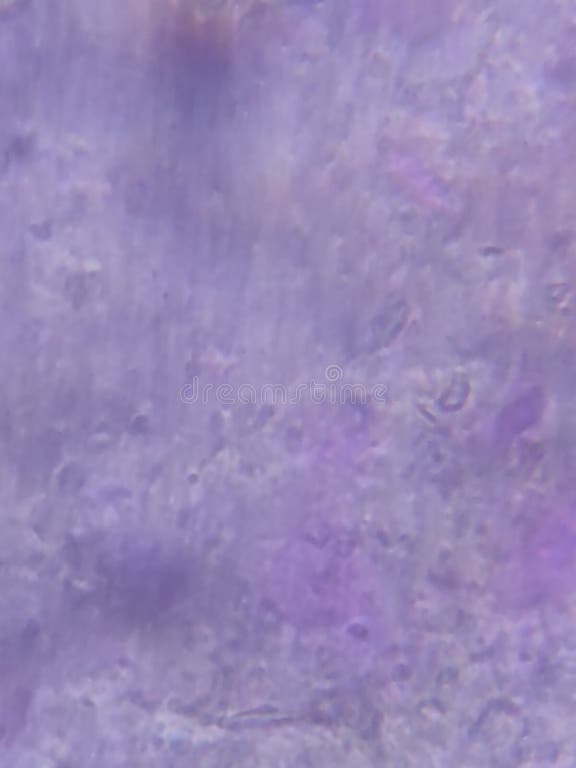 The Brain of a Pig Under the Microscope Stock Photo - Image of brain ...