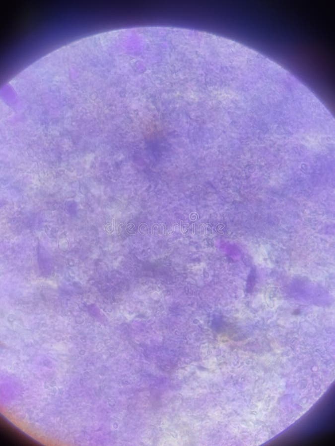 The Brain of a Pig Under the Microscope Stock Photo - Image of ...