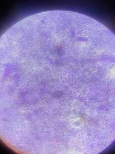 The Brain of a Pig Under the Microscope Stock Image - Image of view ...