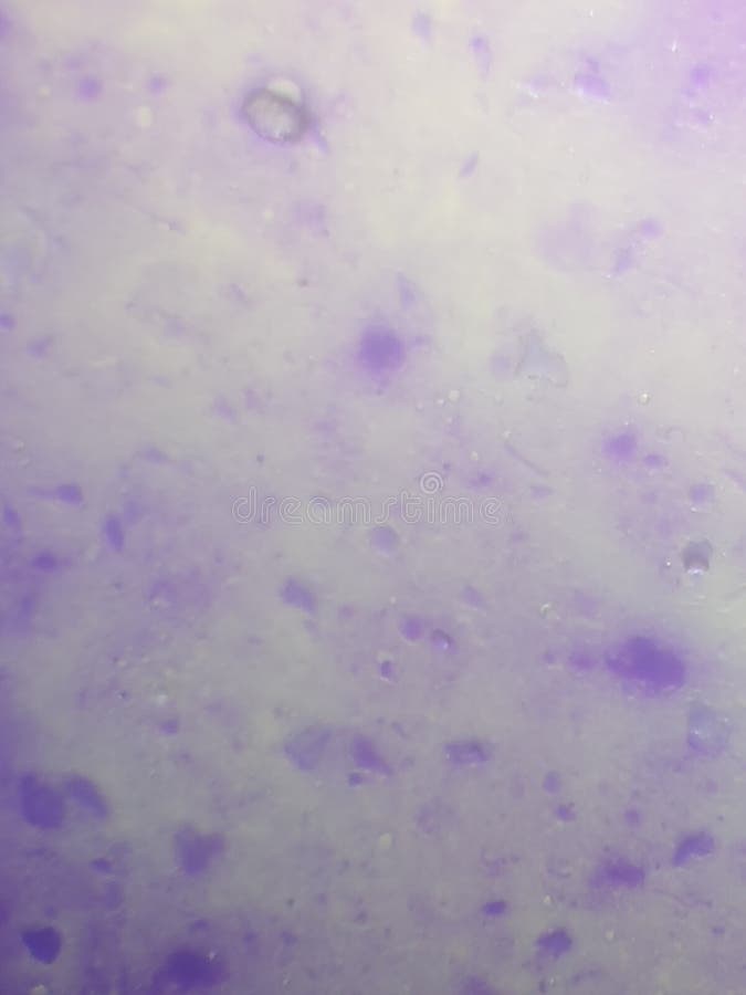 The Brain of a Pig Under the Microscope Stock Photo - Image of ...