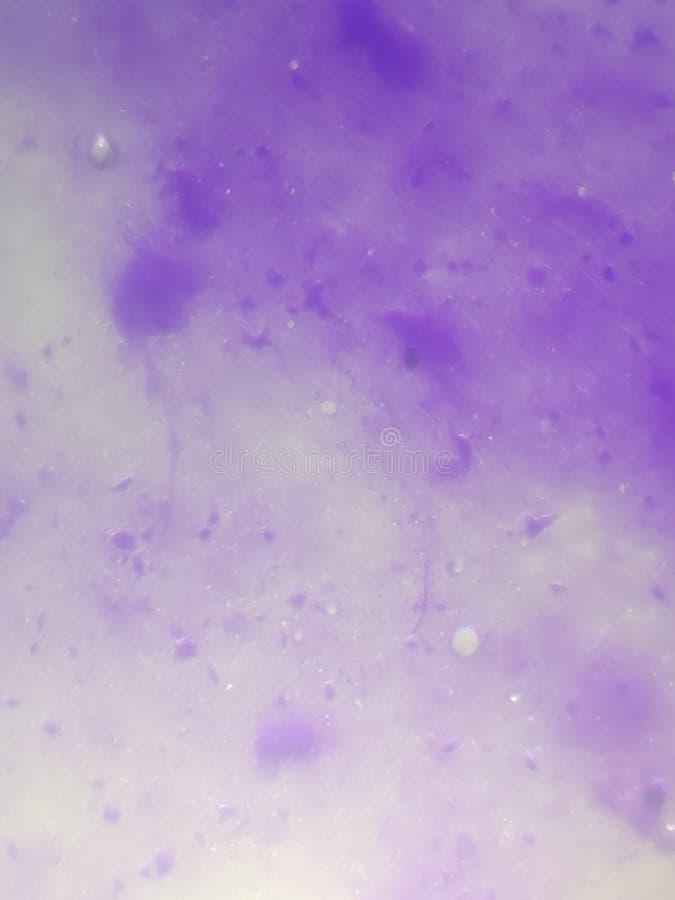 The Brain of a Pig Under the Microscope Stock Image - Image of meat ...