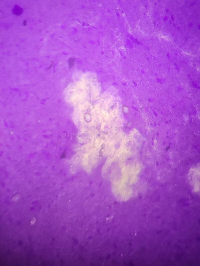 The Brain of a Pig Under the Microscope Stock Image - Image of organ ...