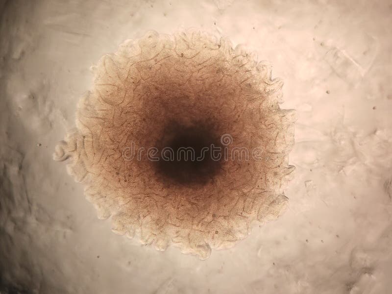 Bacillus Subtilis Beautiful Bacterial Growth Under the Microscope Stock ...