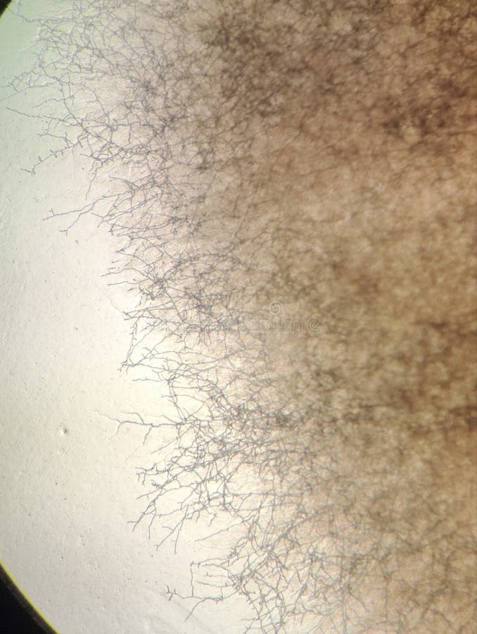 The Mycelium of a Dermatophyte Fungus from Human Skin Stock Photo ...