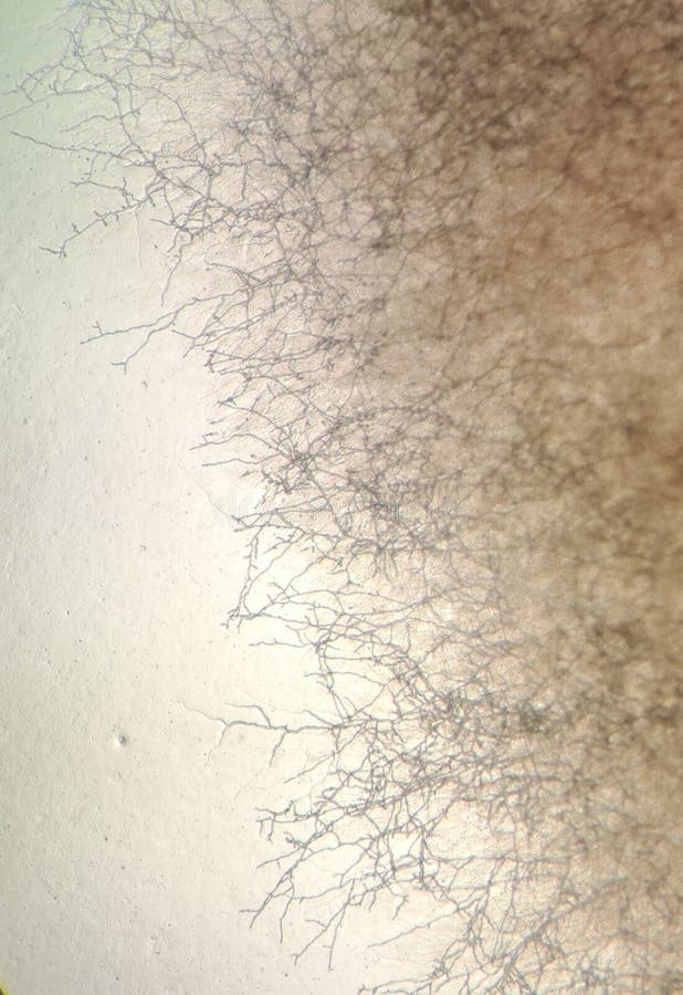 Dermatophyte Fungus Isolated from Human Skin Under the Microscope Stock ...