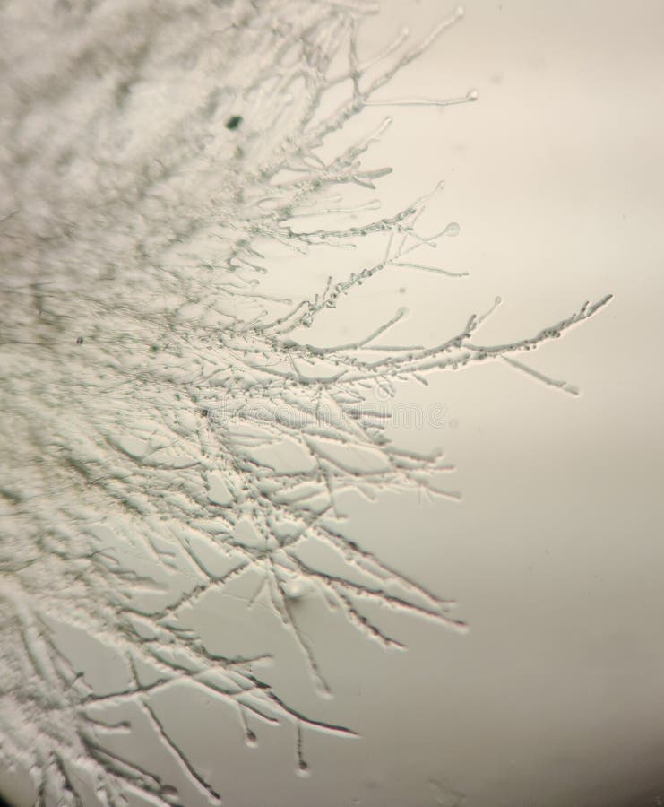Dermatphyte Fungus Under the Microscope Stock Photo - Image of ...