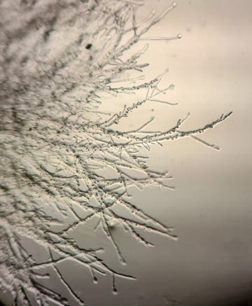 Dermatophyte Fungus Under the Microscope Stock Photo - Image of fractal ...