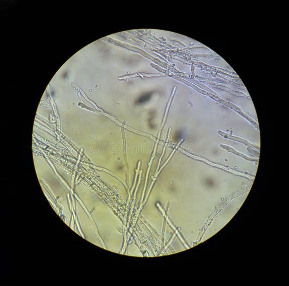 Microscope View of Fungi Mycelium Filaments 40x Increase Stock Image ...