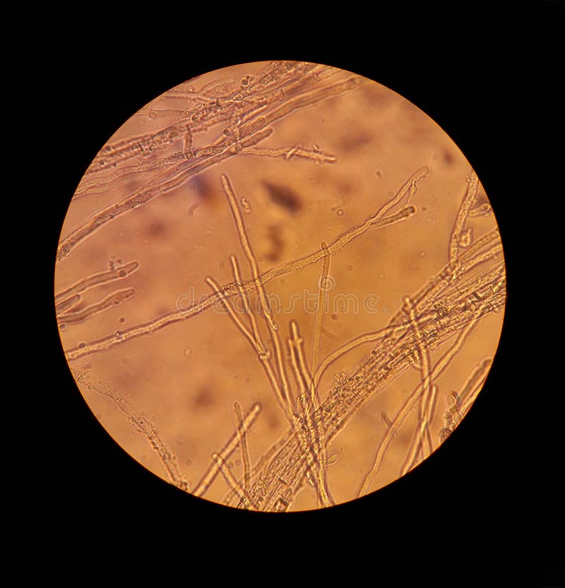 6,477 Fungi Mycelium Photos - Free & Royalty-Free Stock Photos from ...