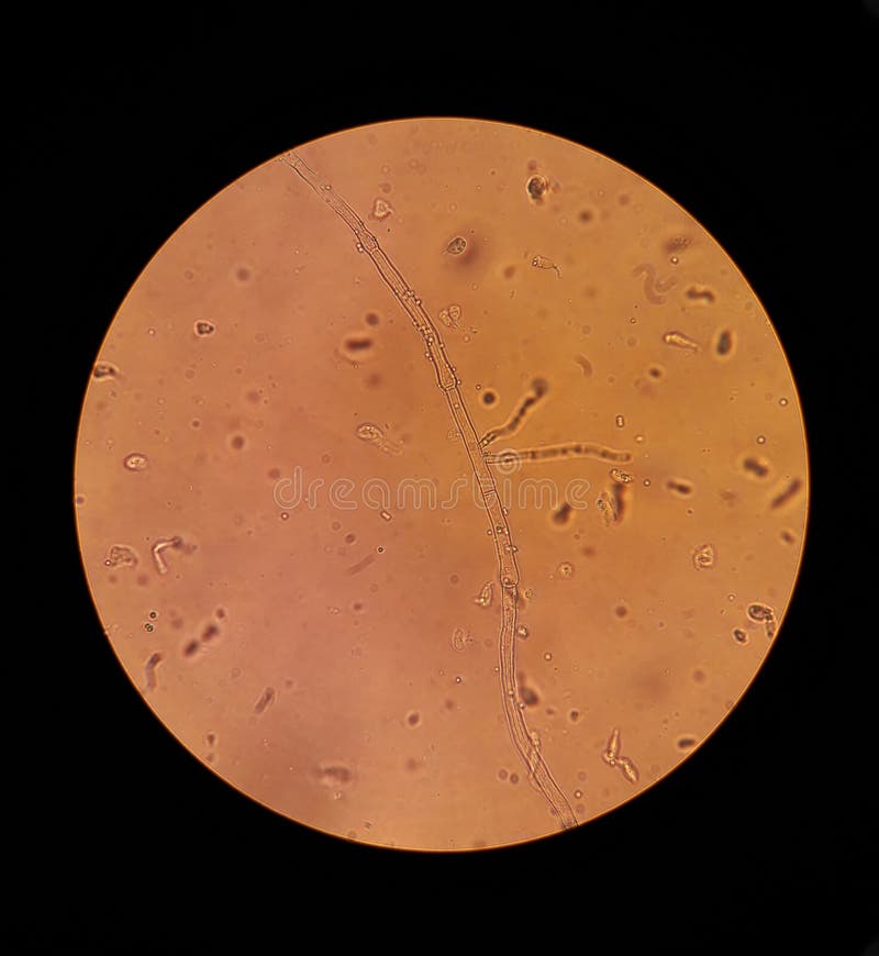 Microscope View of Fungi Mycelium Filaments 40x Increase Stock Image ...
