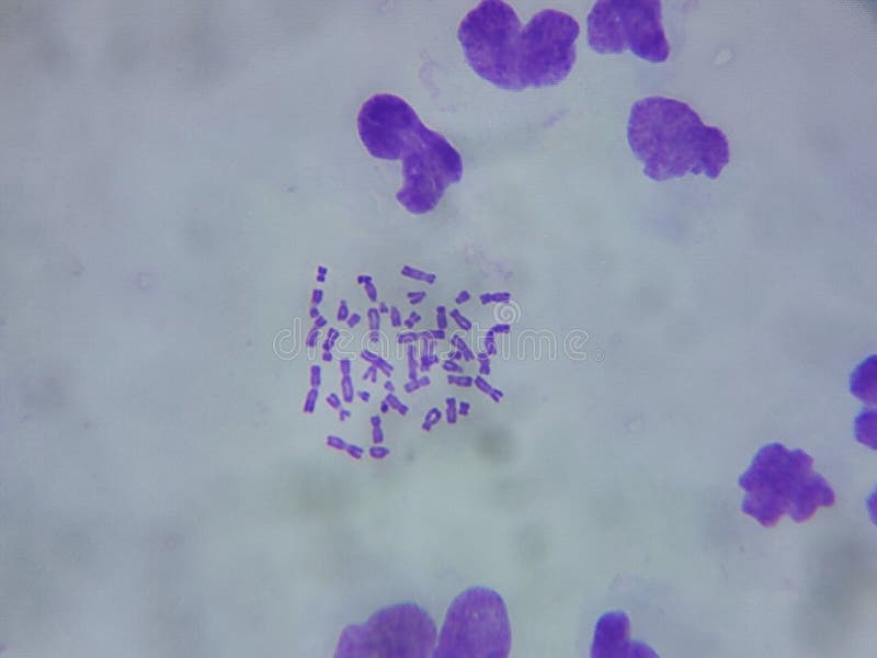 Human Chromosomes Under the Microscope Stock Image - Image of font ...