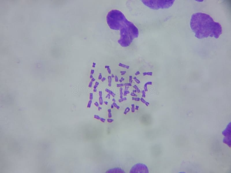 Human Chromosomes Under the Microscope Stock Image - Image of human ...