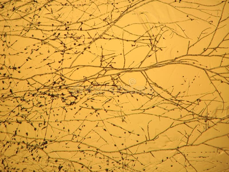 Dermatophyte Fungus Under the Microscope Stock Image - Image of ...