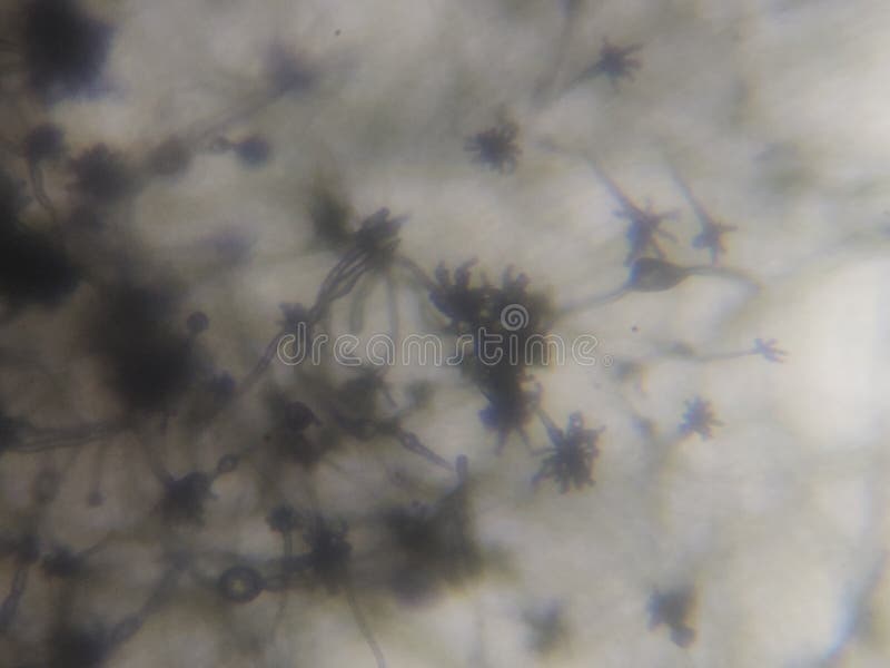 Microscopia De Trichoderma Viridae Imagem de Stock - Imagem de ...