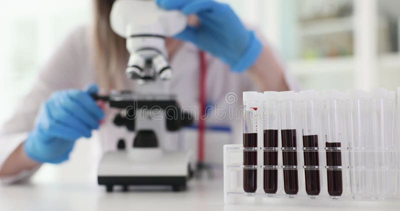 Microscopic Analysis of Blood Samples in Clinical Laboratory Stock ...