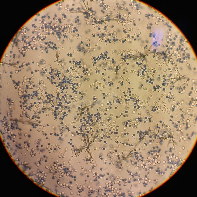 Microscopic bacteria stock image. Image of ceramic, sphere - 196939055