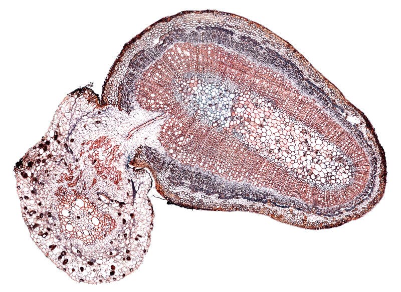 Microscopic Cross Section Cut of a Plant Stem Under the Microscope ...