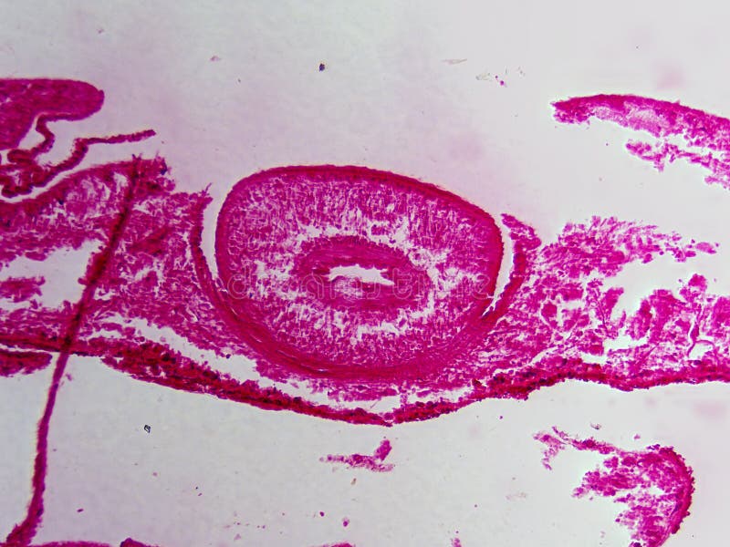 Planaria Anatomy Stock Photos - Free & Royalty-Free Stock Photos from ...