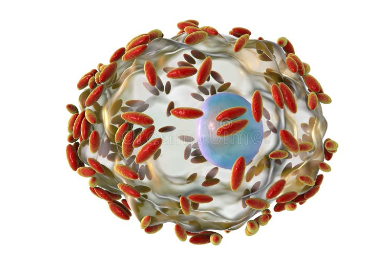 Microscopic Diagnosis of Bacterial Vaginosis. Epithelial Cell, so ...