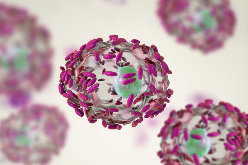 Microscopic Diagnosis of Bacterial Vaginosis. Epithelial Cell, so ...