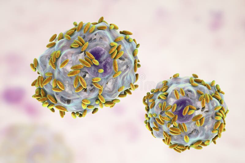 Microscopic Diagnosis of Bacterial Vaginosis. Epithelial Cell, so ...