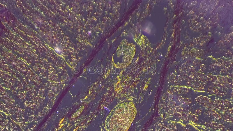 Human Kidney with Blood Vessel Injected in Section Filmed Under ...