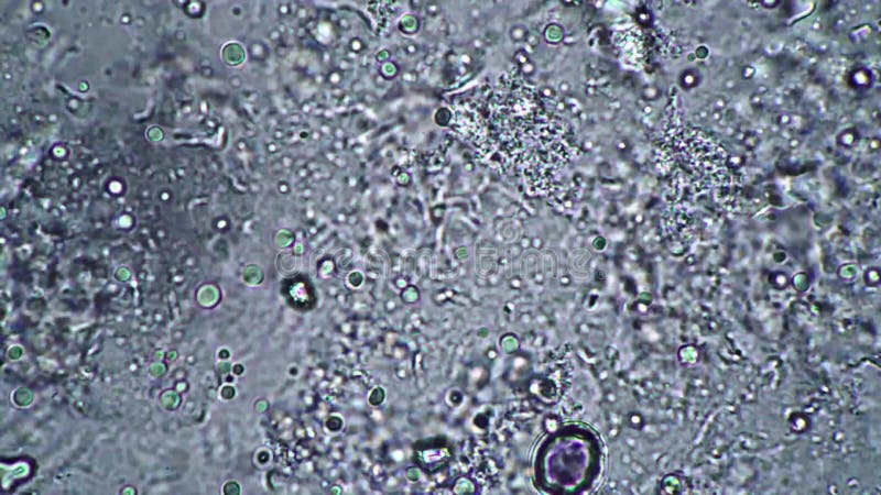 Microscopic Footage of Some Anonymous Bacteria Moving Rapidly Under the ...