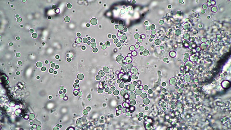 Microscopic Footage of Some Anonymous Bacteria Moving Under the ...