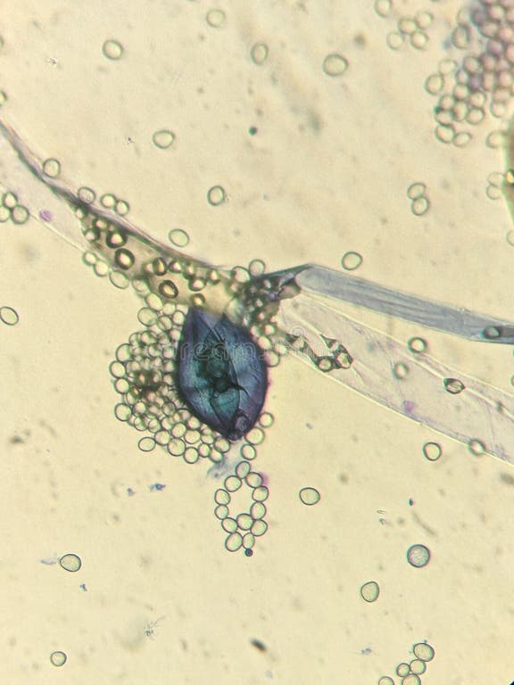Microscopic Fungal Spores Under Light Microscope. Stock Photo - Image ...
