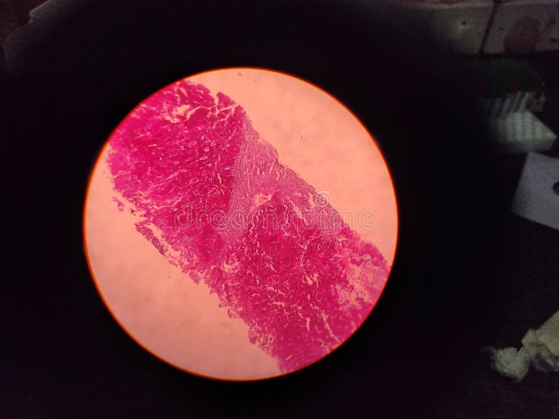 Microscopic Image of a Human Tissue Stain Slide. Histology Stain Stock ...