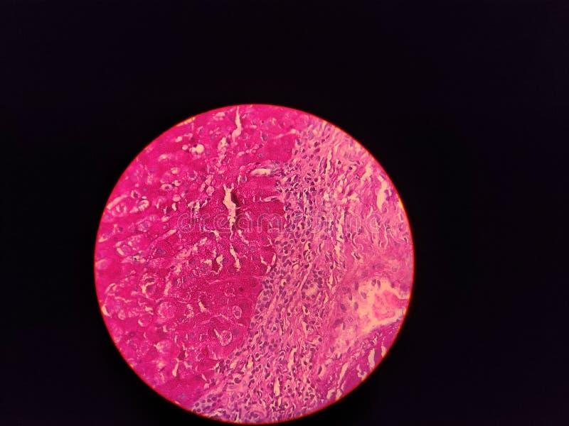 Microscopic Image of a Human Tissue Stain Slide. Histology Stain Stock ...