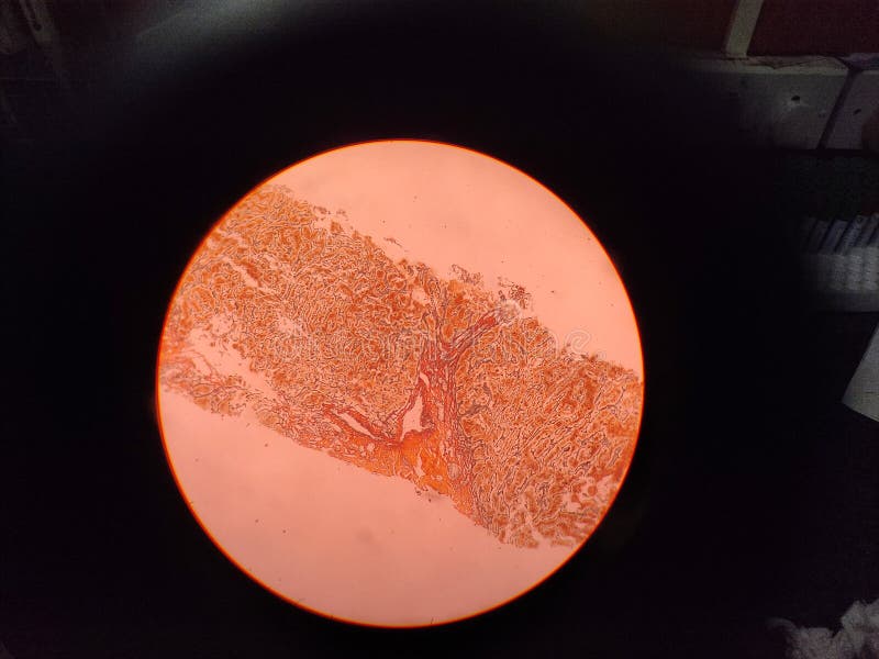 Microscopic Image of a Human Tissue Stain Slide. Histology Stain Stock ...