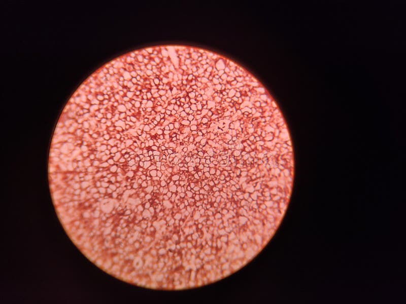 Microscopic Image of a Human Tissue Stain Slide. Histology Stain Stock ...