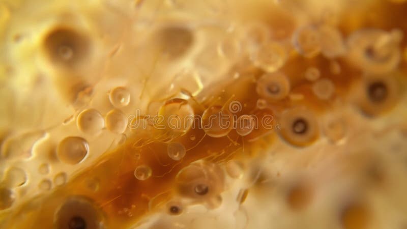 A Microscopic Image of a Parasitic Cyst Containing Hundreds of Dormant ...