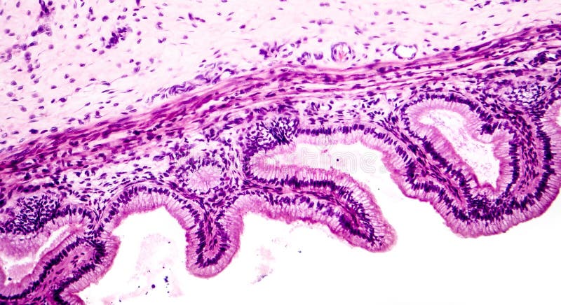 Microscopic Image Showing Epithelium of Urinary Bladder Stock Photo ...