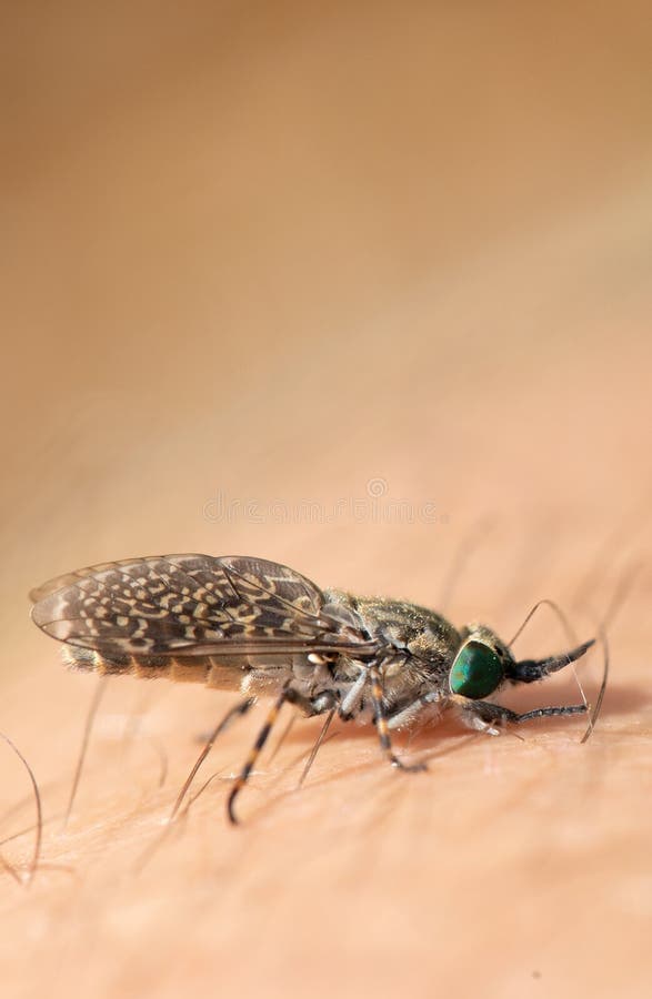 Bugged Skin: Examining the Impact of an Insect S Bite Stock Photo ...