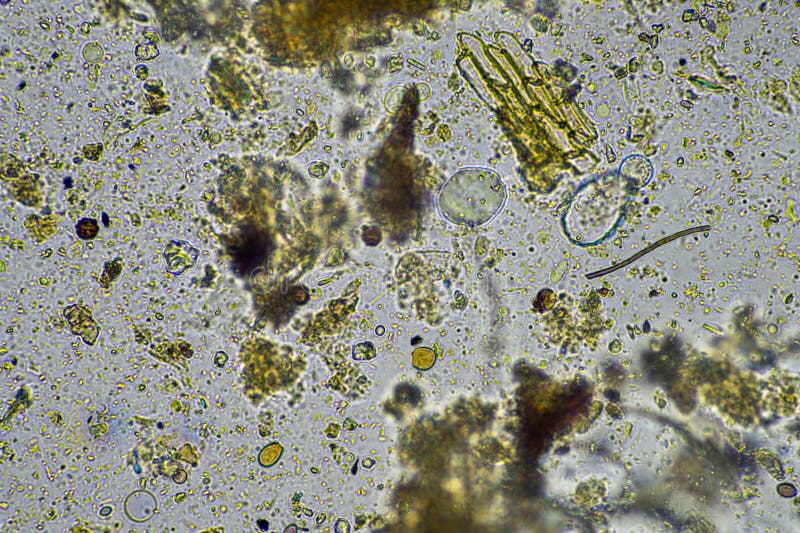 Microscopic Microorganisms Under the Microscope in a Soil Sample Stock ...